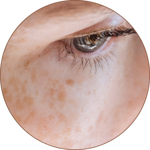 Buy Anti-Pigmentation Skincare | Natural Brightening Solutions – Revite ...